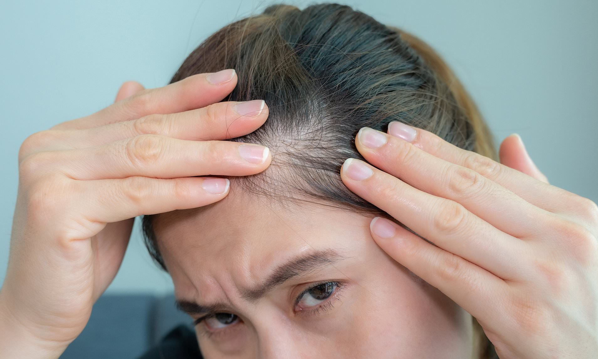 Hair loss expert names the trendy hairstyle causing women to go bald ...