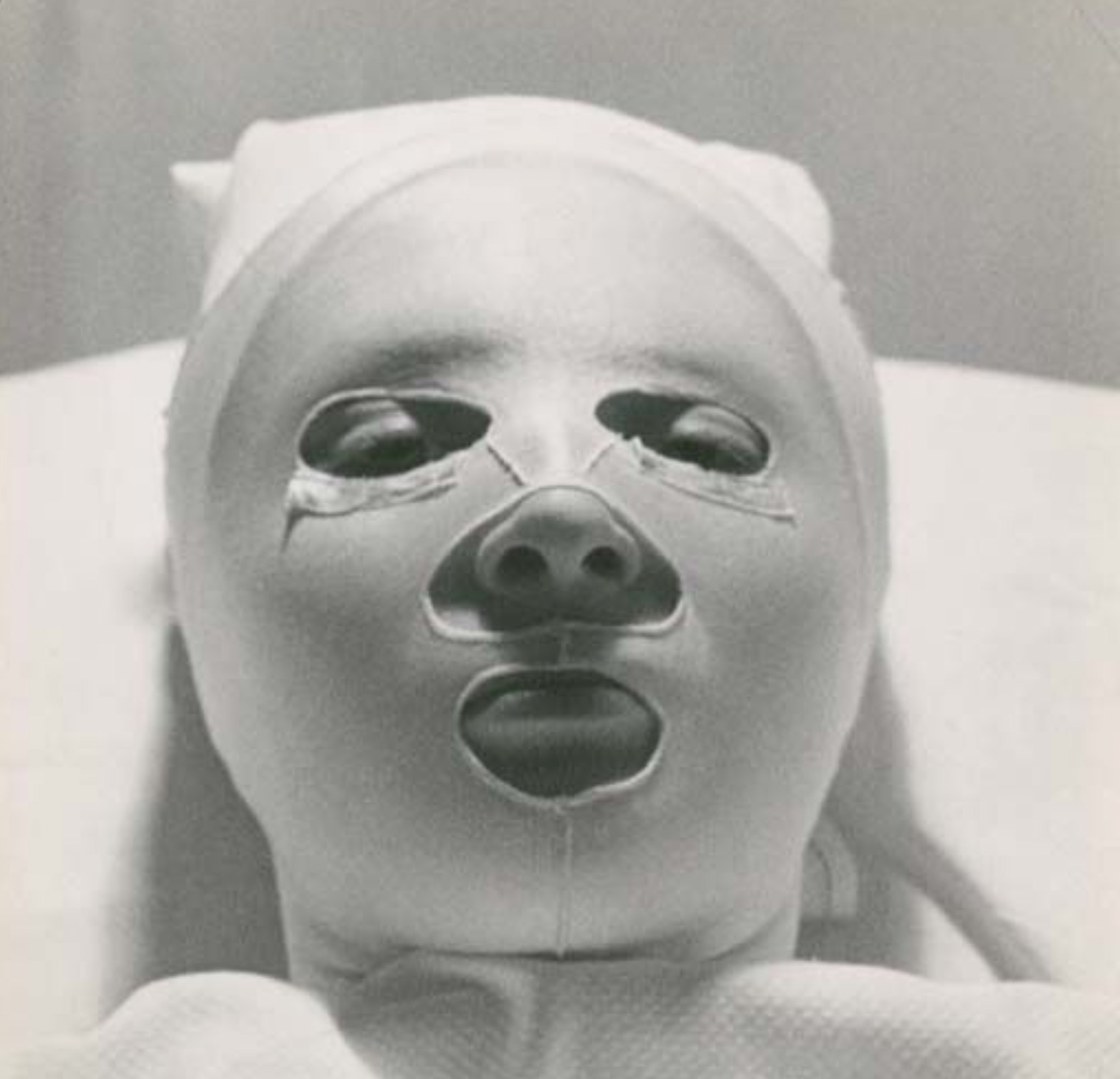 Vintage Beauty Devices That Look Like Torture