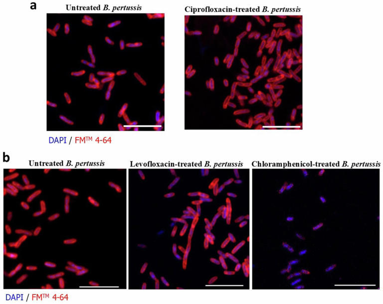 New nasal vaccine has potential to transform respiratory disease prevention