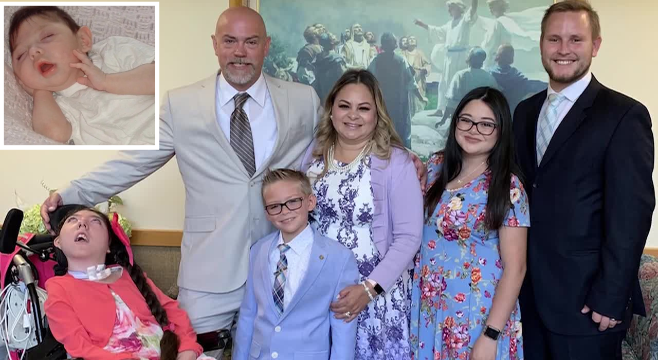 US woman born without brain celebrates 20th birthday after doctors said ...