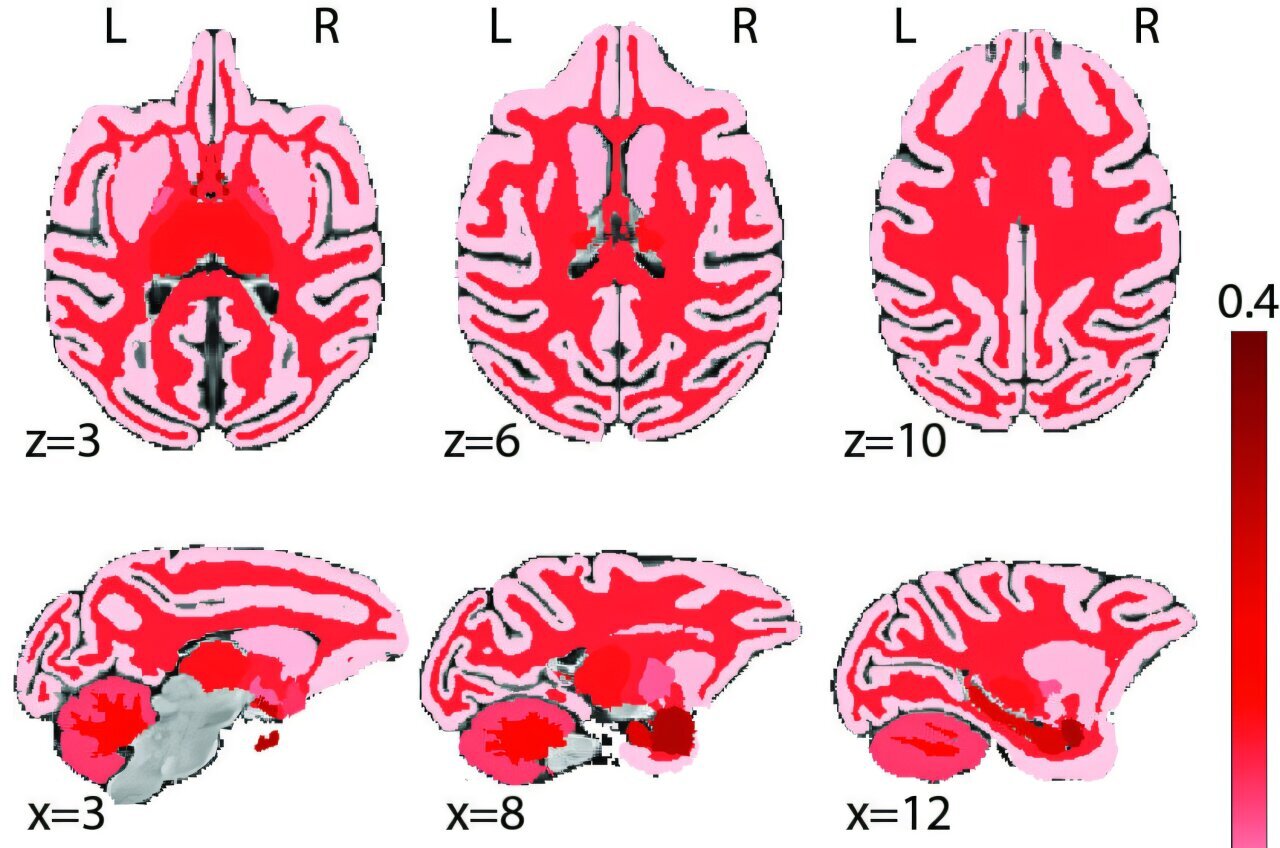 White matter connections may drive adolescent cognitive gains, study ...