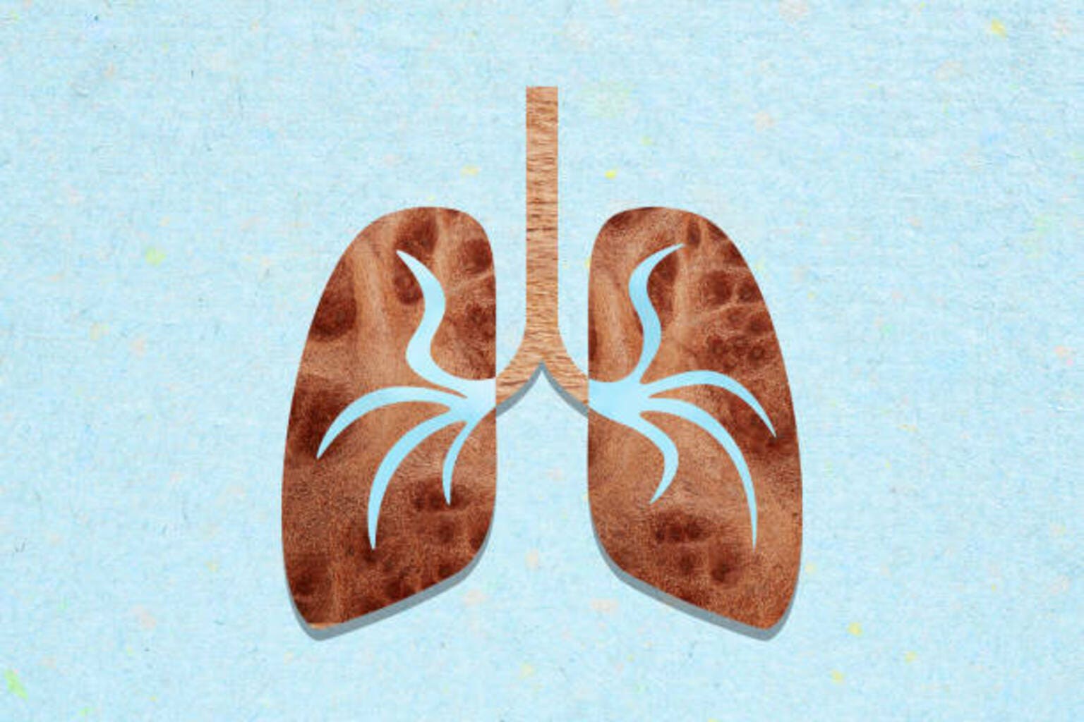 MannKind slides after halting late-stage trial of MNKD-101 for lung disease