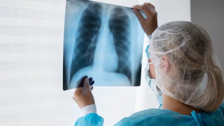 Un análisis de sangre predice qué pacientes con cáncer de pulmón se ...