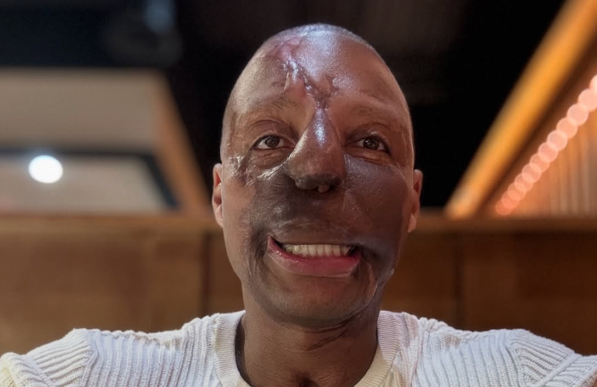 What happened to Randy Adams? Rise up Ran was reportedly brutally attacked