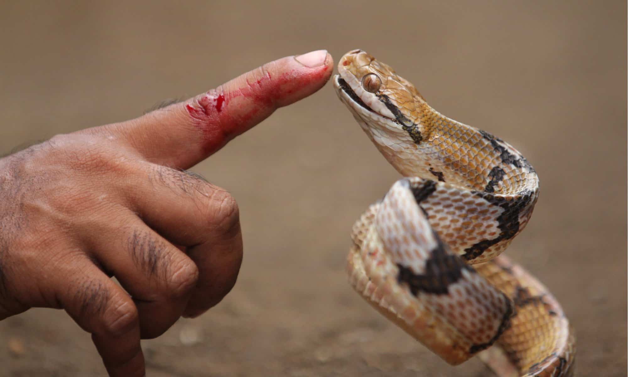Hate snakes? This US state has more than 1,400 snake bites every year