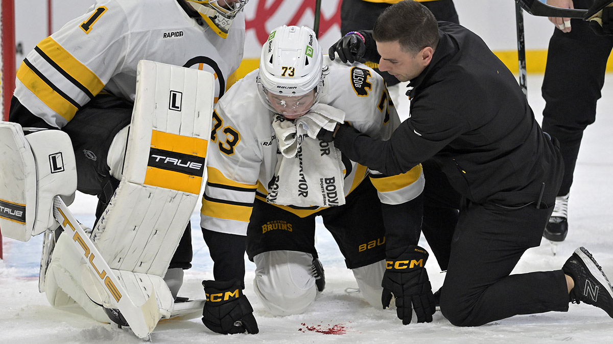 Surgery a possibility for McAvoy after taking puck to the face in Montreal