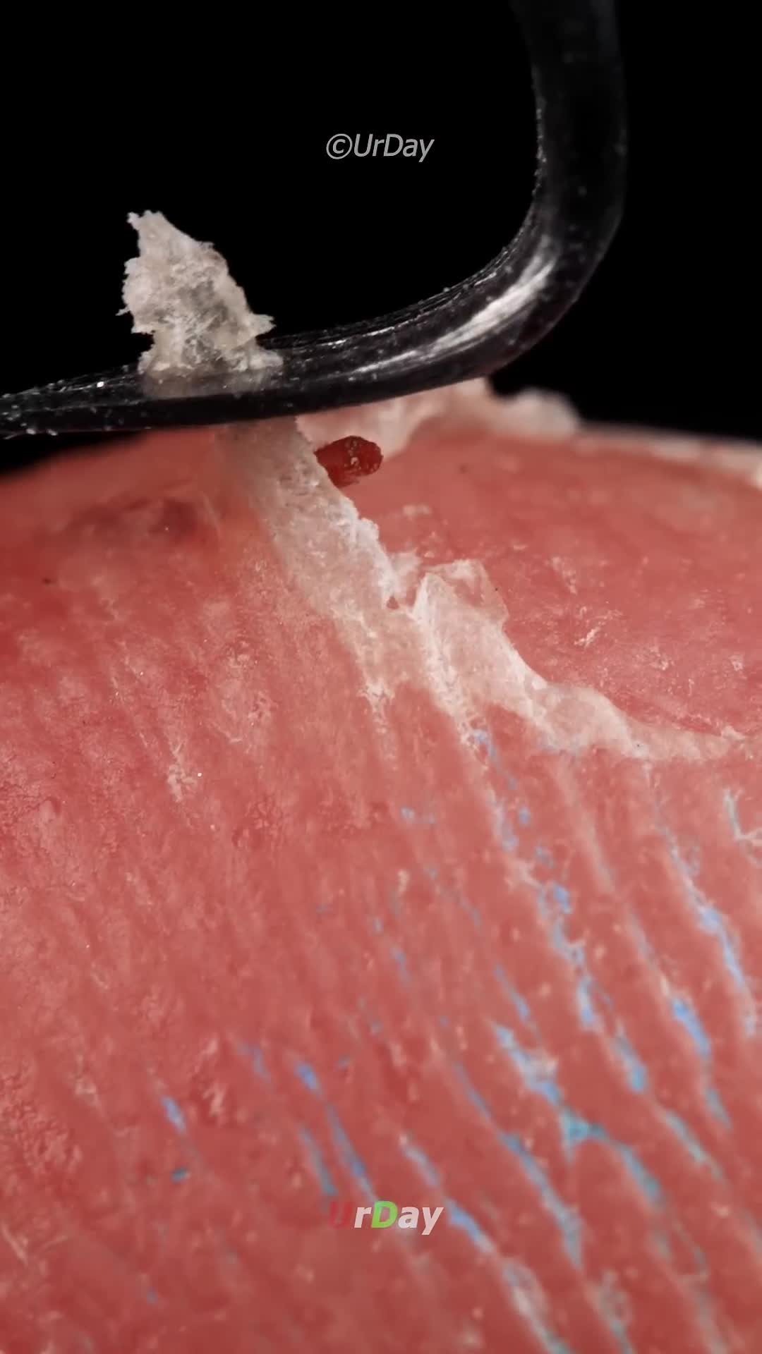 Finger splinter pulling out close-up #satisfying #urday #asmr