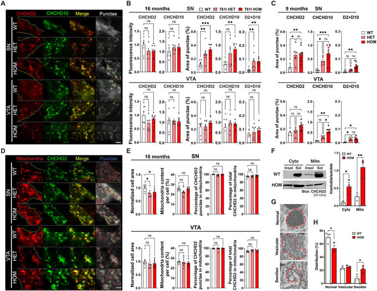 Evidence builds for disrupted mitochondria as cause of Parkinson's