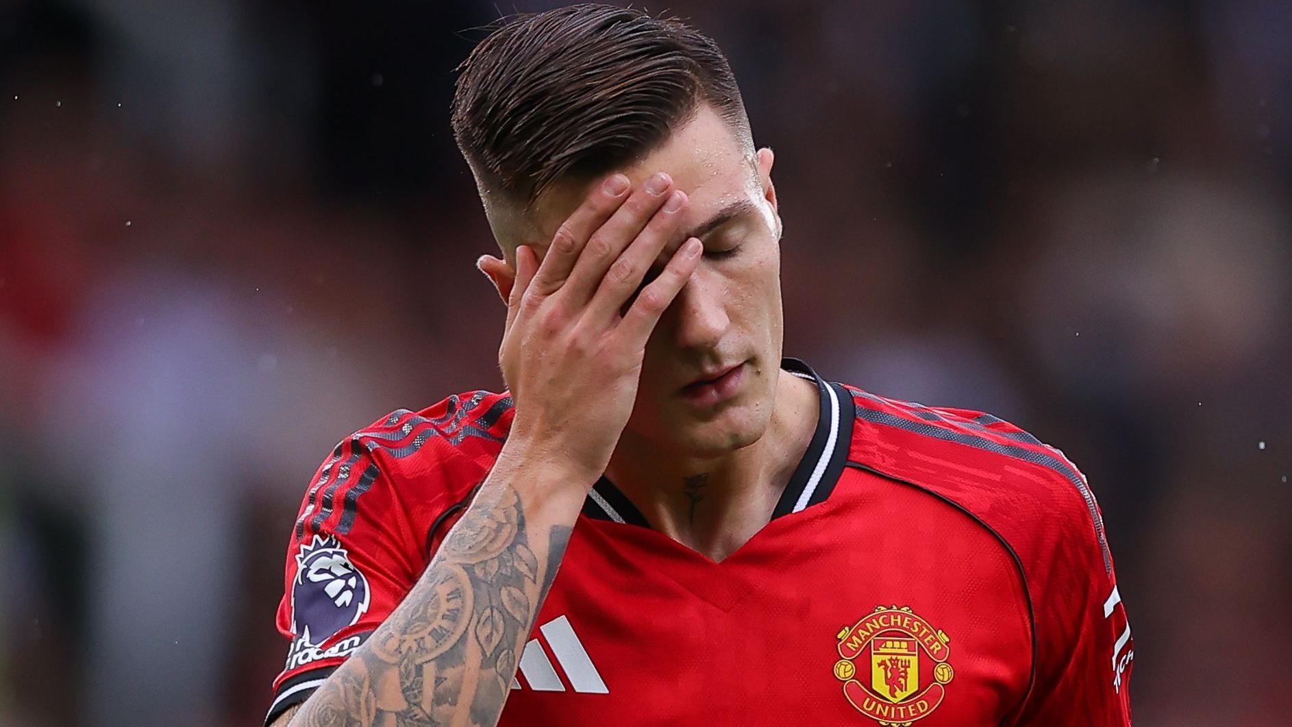 Man Utd's Sesko out for a month with knee injury