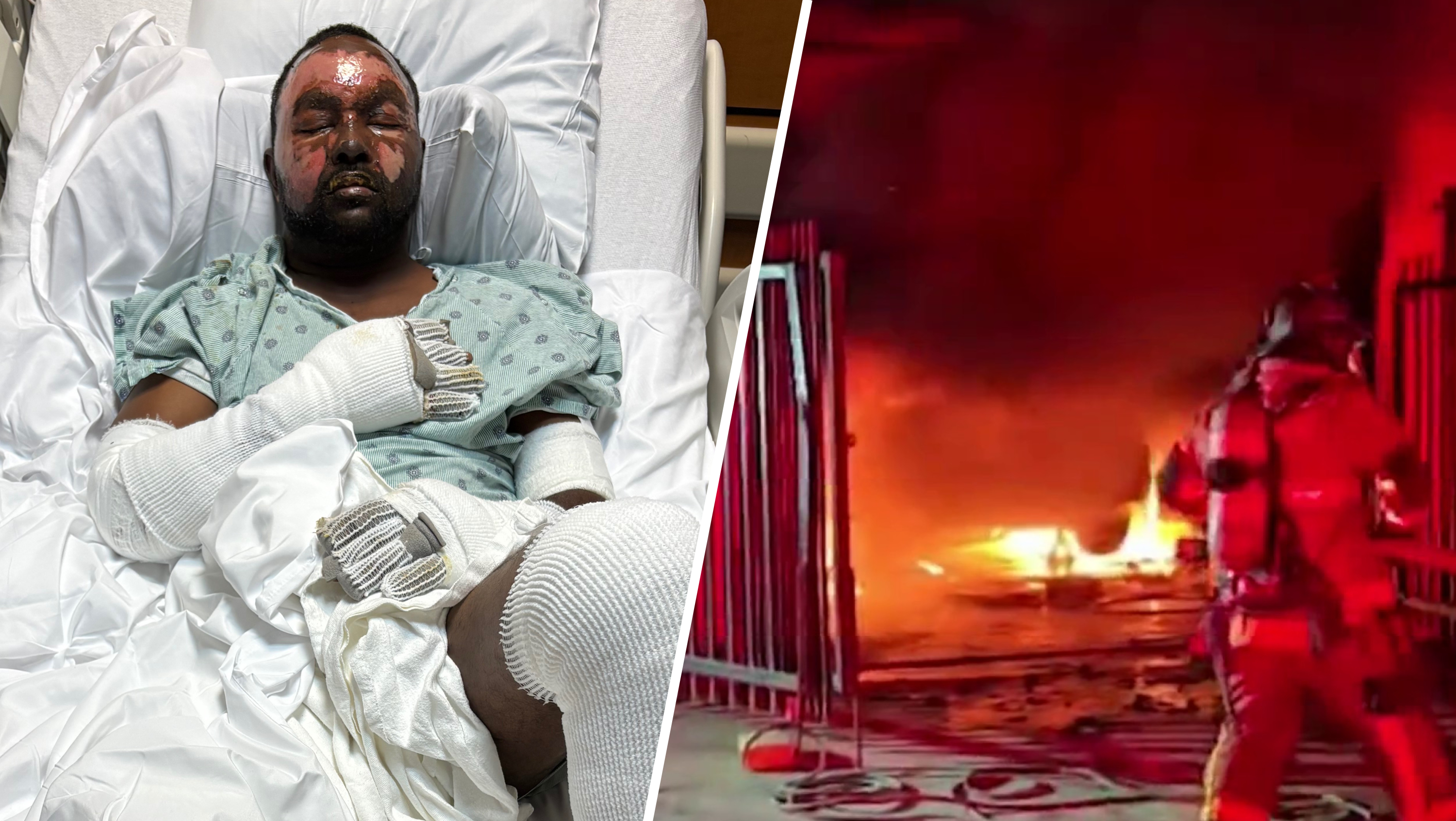 Owner badly burned after massive fire at Opa-locka auto shop