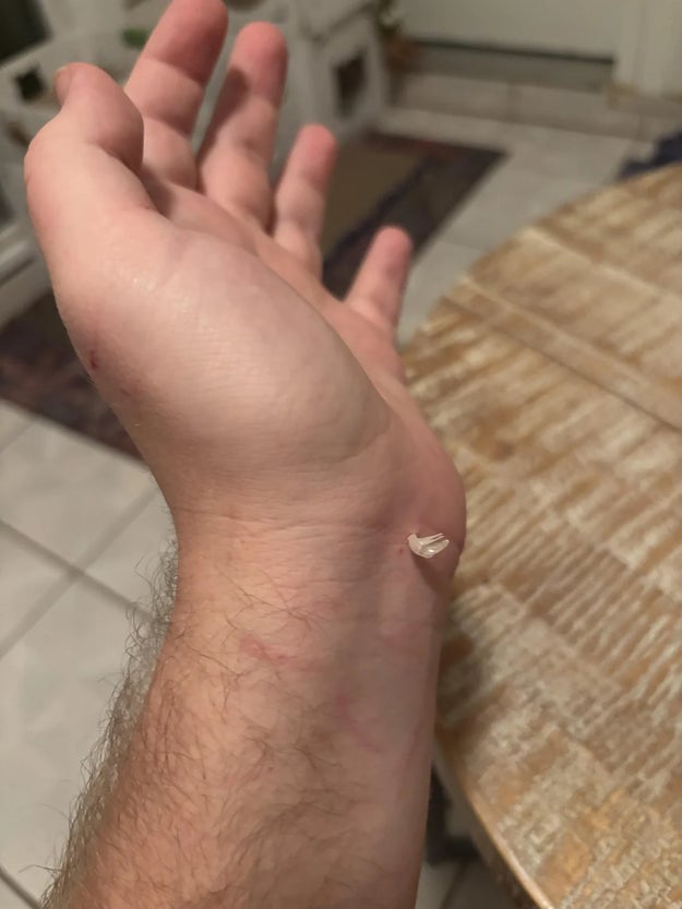 21 Photos That Are So Physically Uncomfortable To Look At, They Made My ...