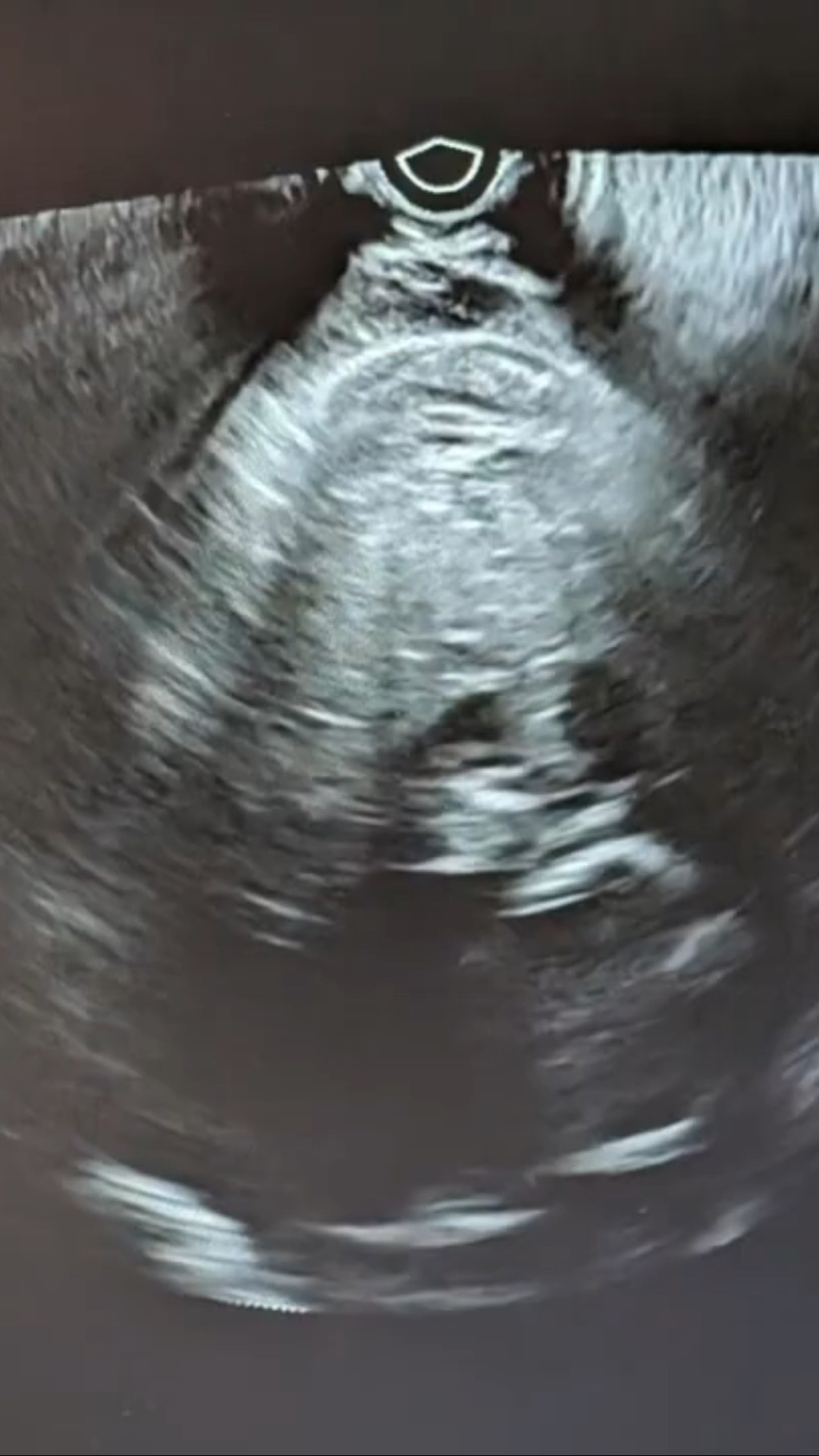 Cameron Park Zoo expecting baby orangutan!