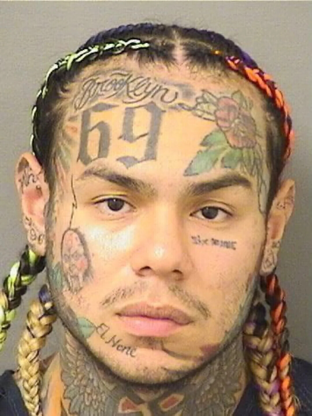 20 Tattoos Where a Removal Would Benefit Everyone