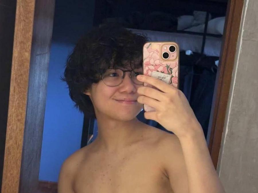 Nic Chien shares results of top surgery on social media