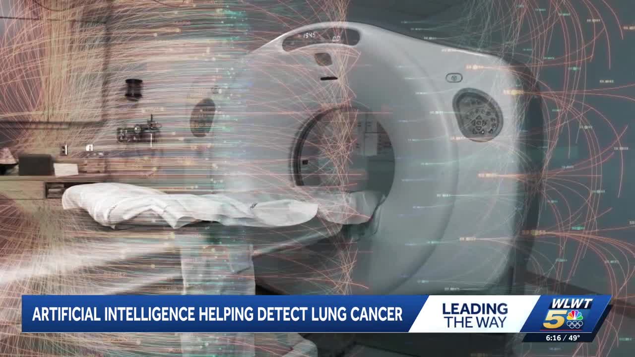 Artificial Intelligence Helping To Improve Early Lung Cancer Detection 3147