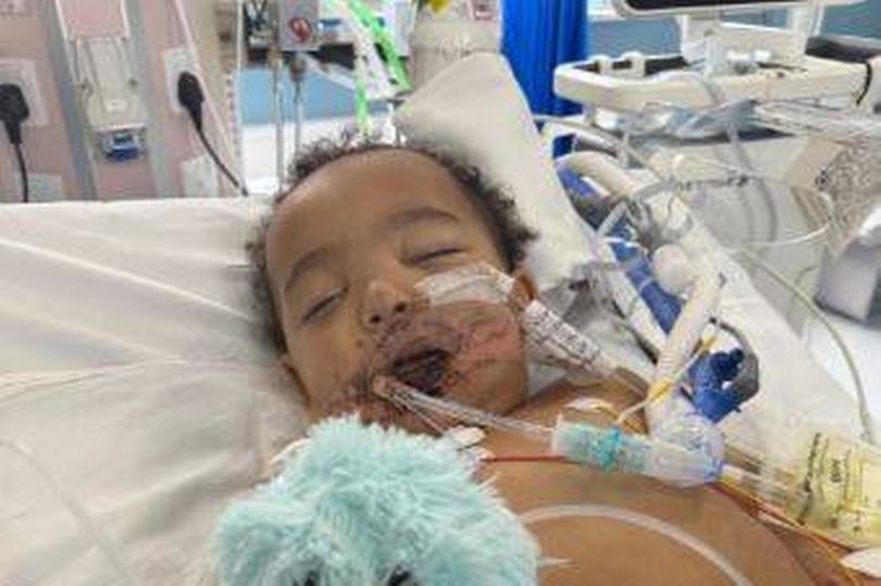 'Miracle' baby suffers heart attack and loses half his tongue in horror ...