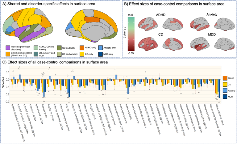Striking discovery about what mental health conditions do to the brain