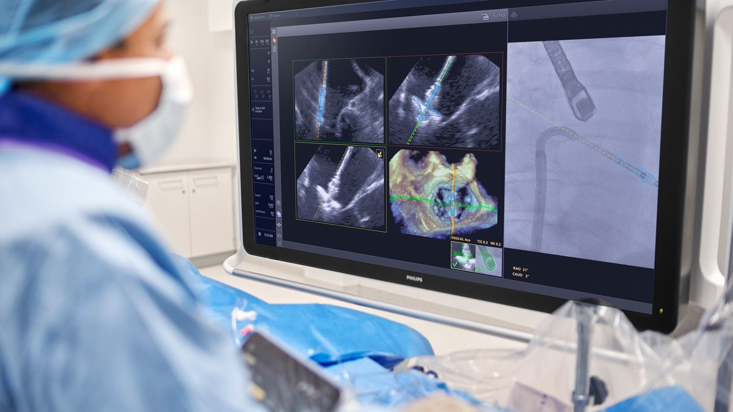 Philips launches DeviceGuide for complex heart valve repairs