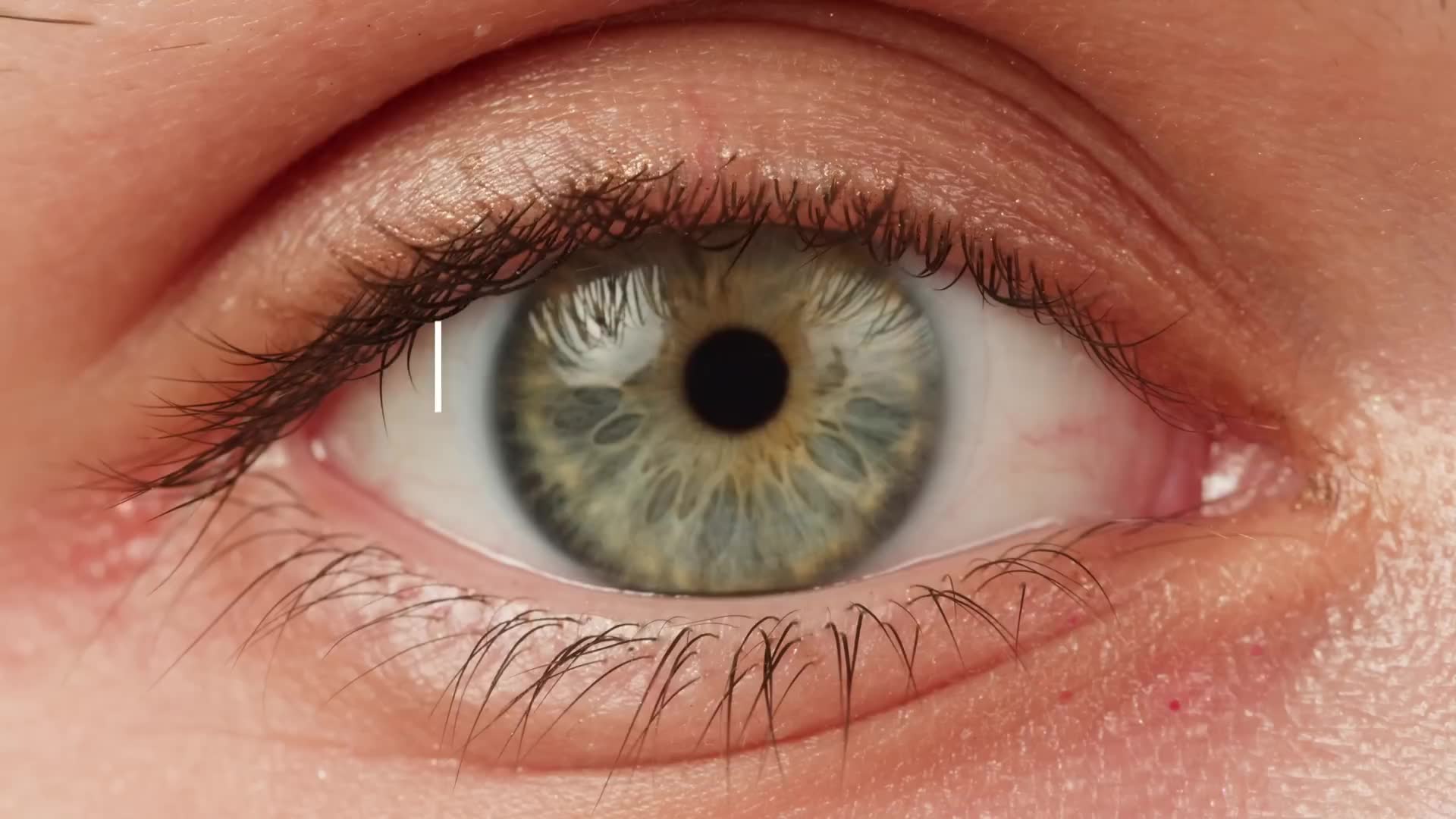 Relieving chronic dry eye syndrome: practical solutions from lubricants ...