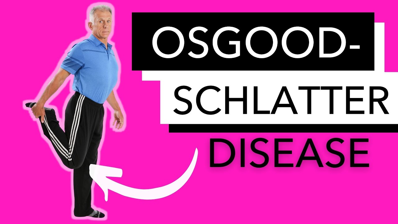 How to Treat Osgood-Schlatter Disease of the Knee