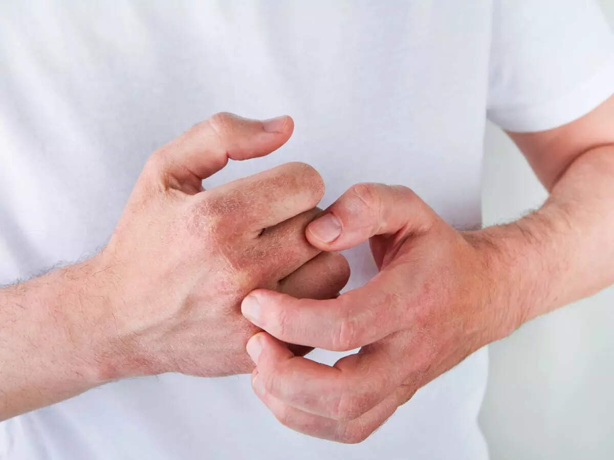 That cracking sound while lifting something? It might be arthritis ...