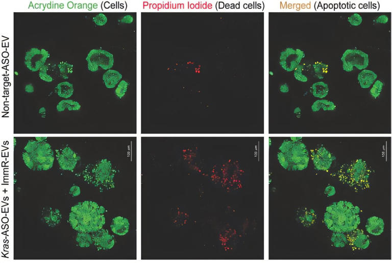 RNA therapy silences KRAS gene and boosts immune attack on cancer cells