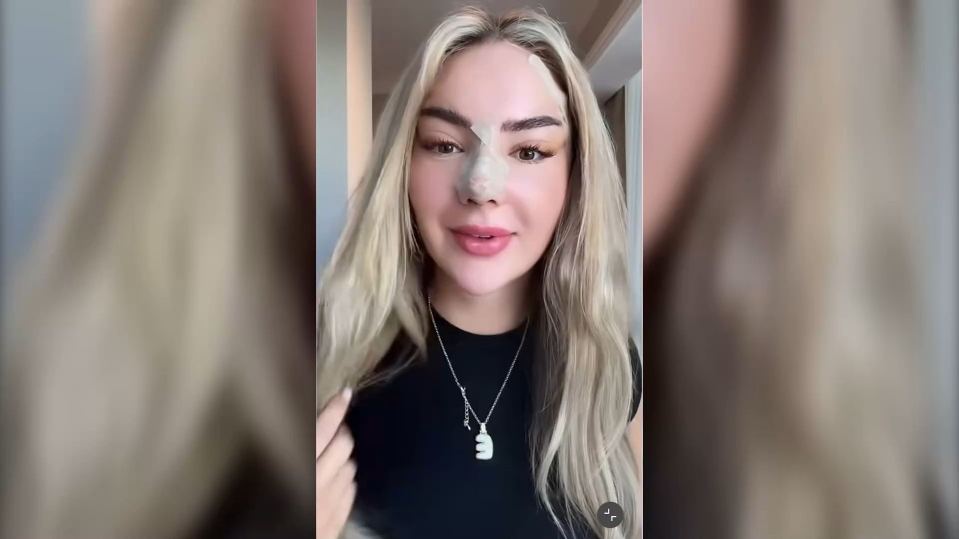 Emma Fernlund: User spotten nach Beauty-OP – "Sieht aus wie Kim ...
