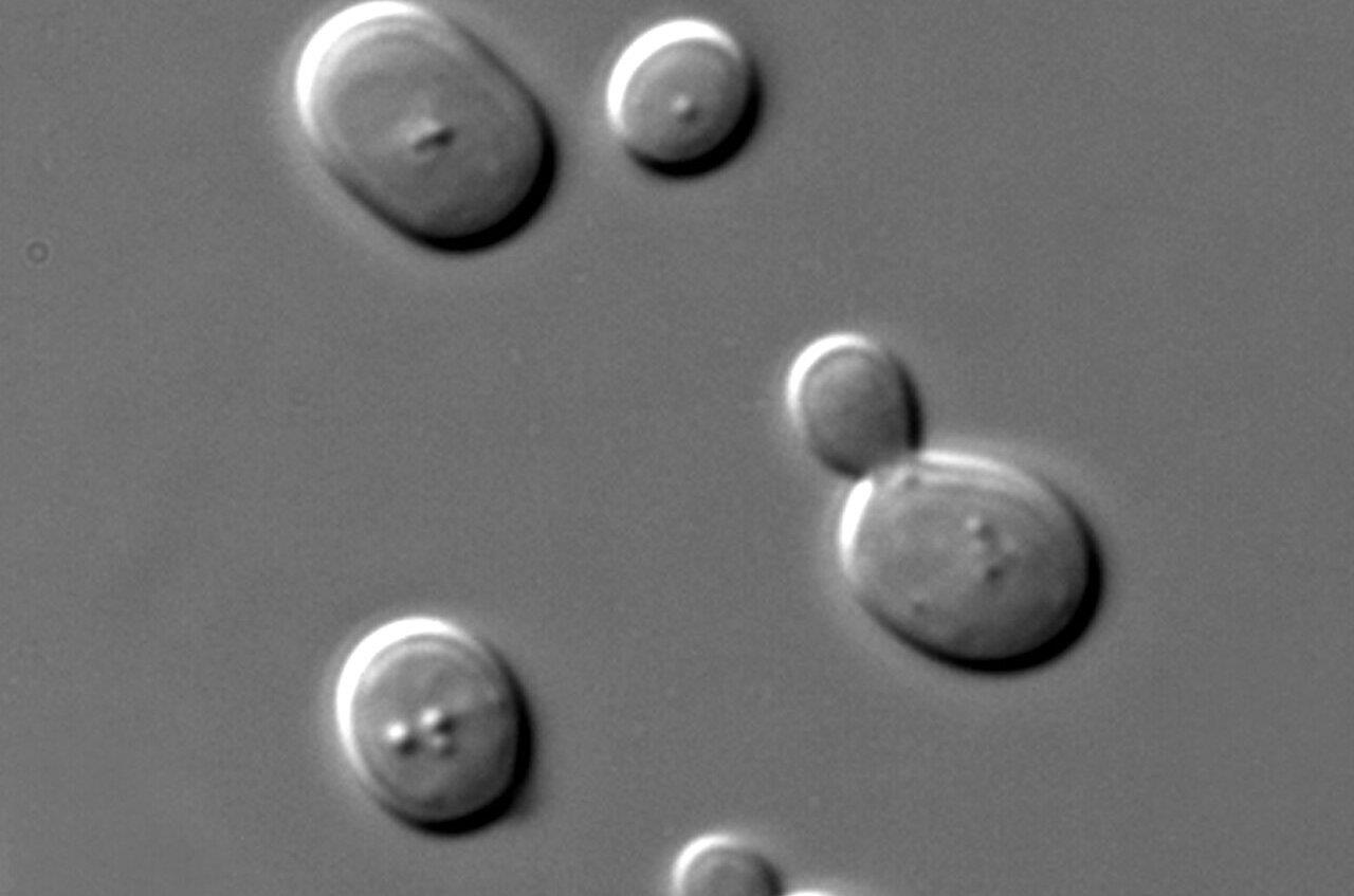 Extending yeast lifespan boosts biosynthetic output of valuable compounds