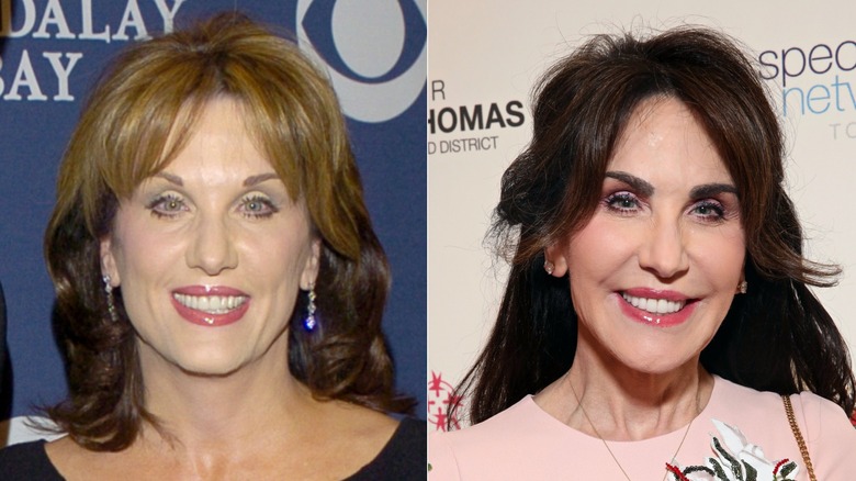 The Cosmetic Procedures Dr. Phil's Wife Robin Admits To Getting