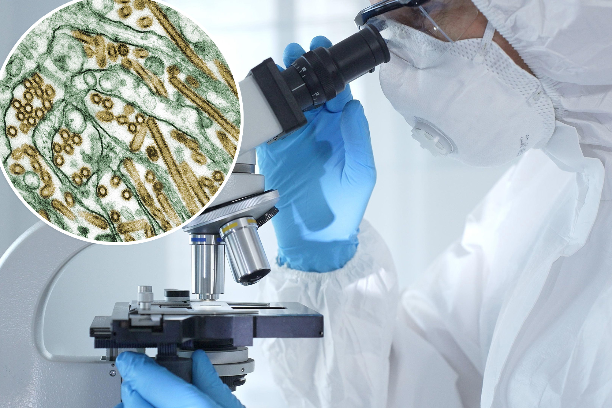 Washington man ‘severely ill’ with ‘unpredictable’ virus never before ...