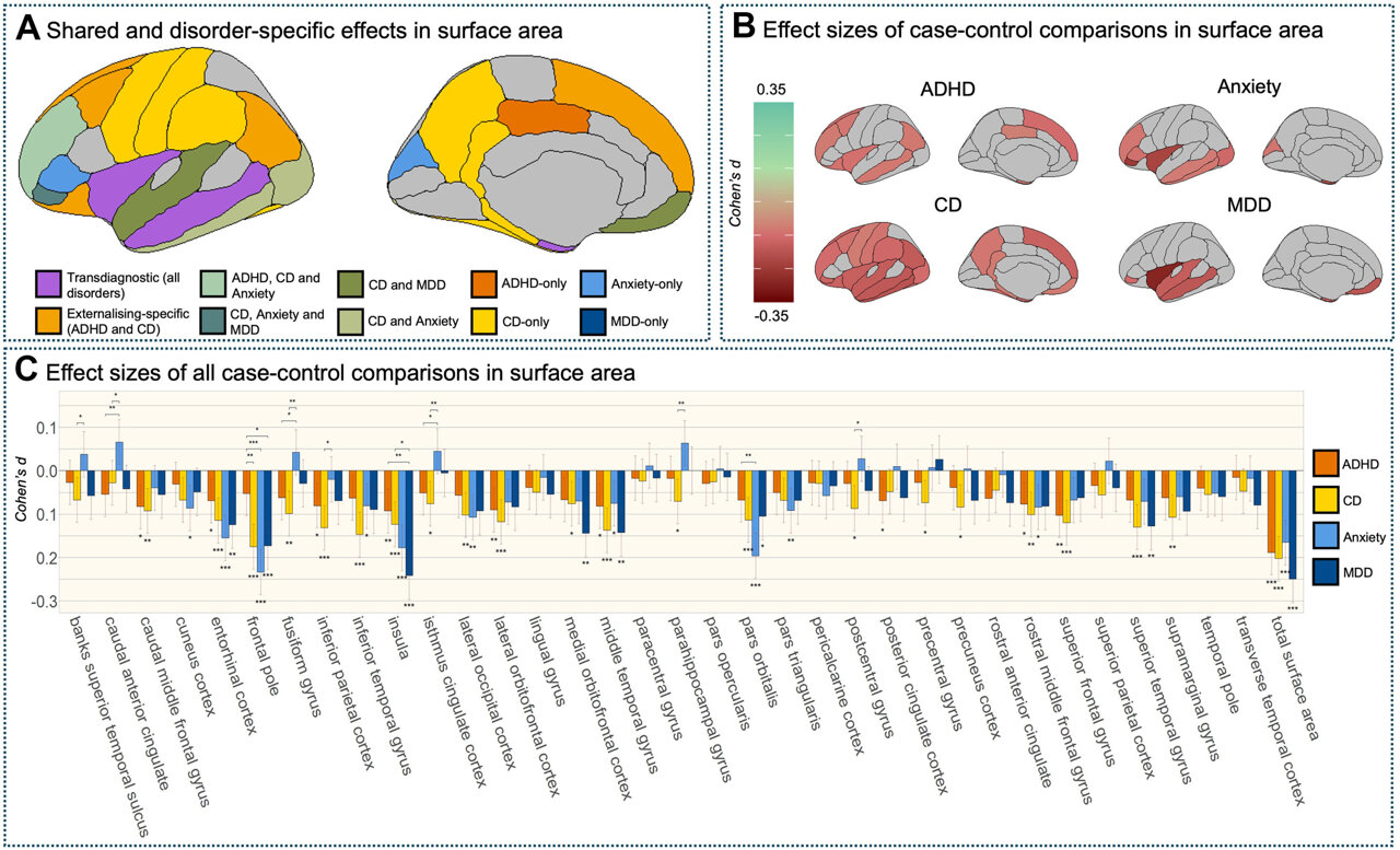 Youth with mental health conditions share strikingly similar brain ...