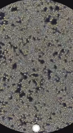 The Secret Life of Yeast Revealed Under the Microscope