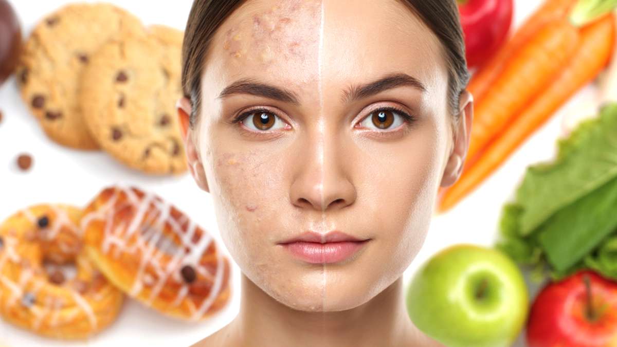 If you eat them often, you risk pimples and dull skin: here are the ...