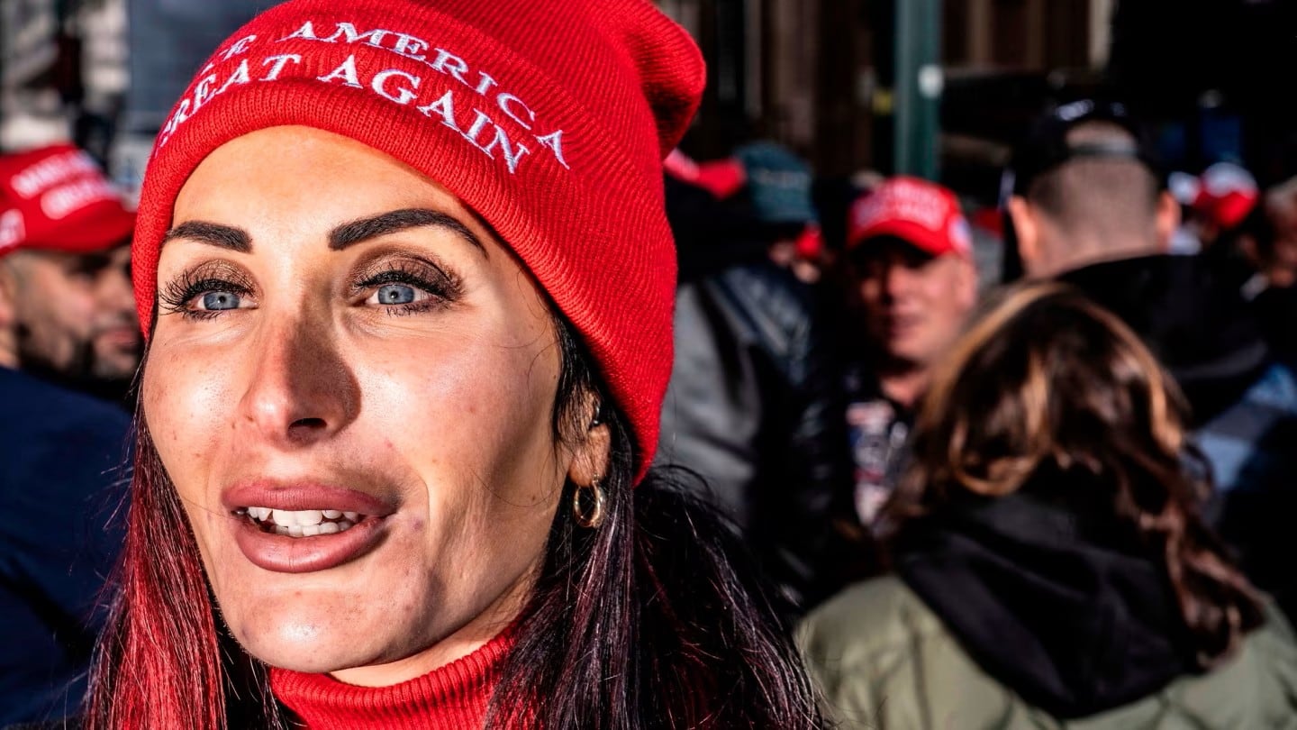 Trump Allies Embrace ‘Mar-a-Lago Face’ Plastic Surgery Trend in ...