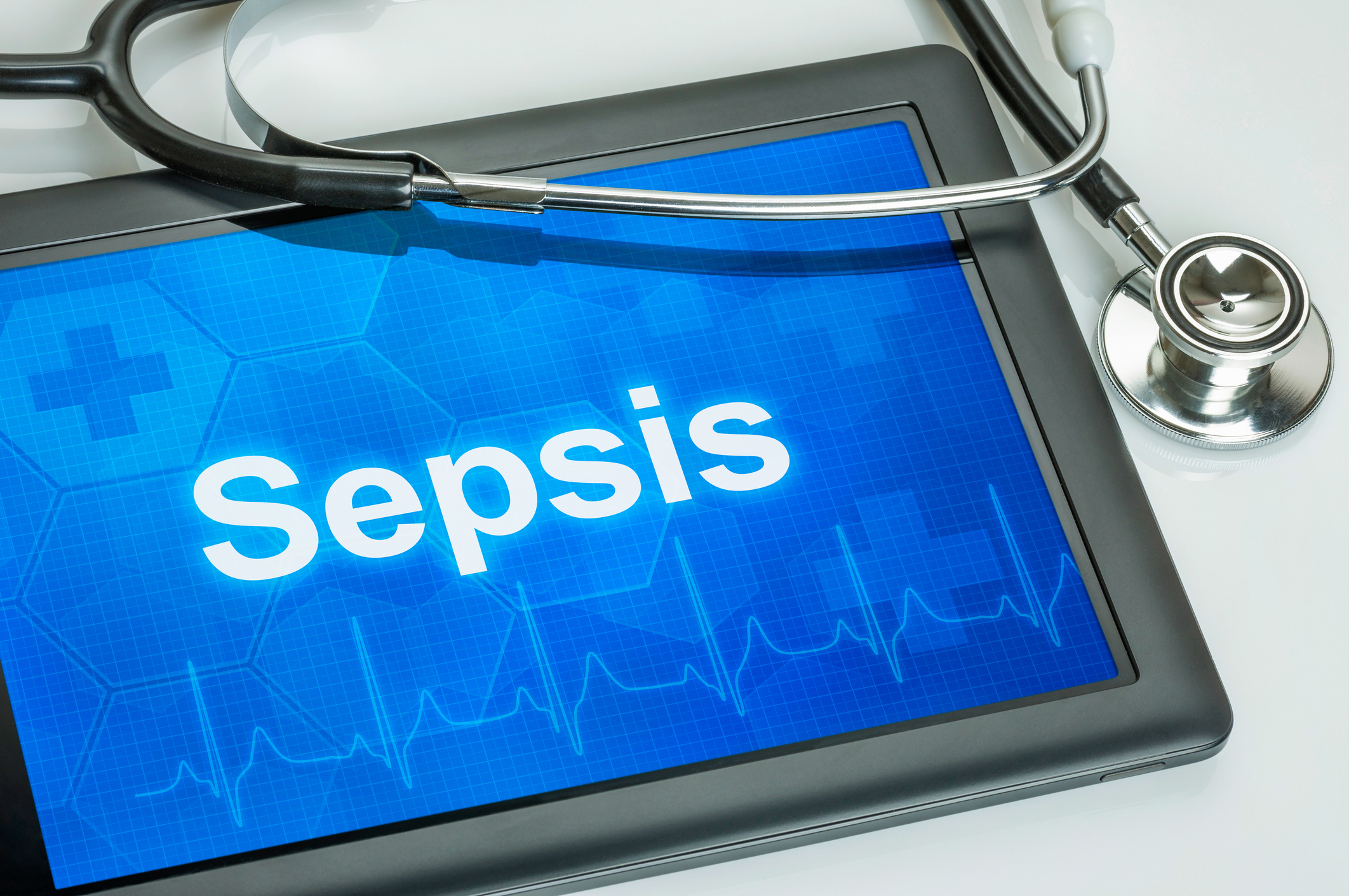 Mayo Clinic Q&A: Consider TIME when dealing with sepsis