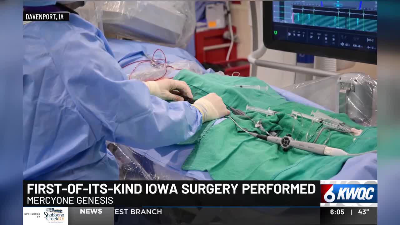 MercyOne Genesis doctor performs first-of-its-kind heart surgery in Iowa