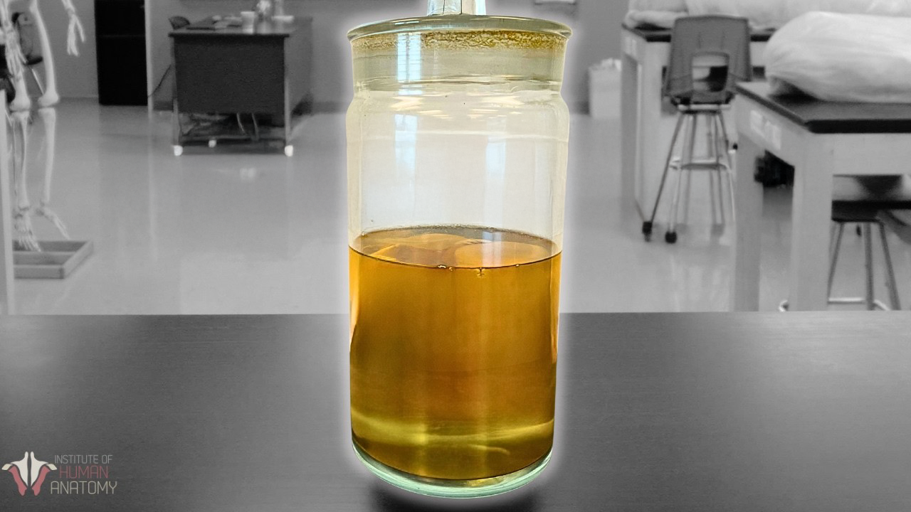 The Strange Case of the Stolen Lab Specimen