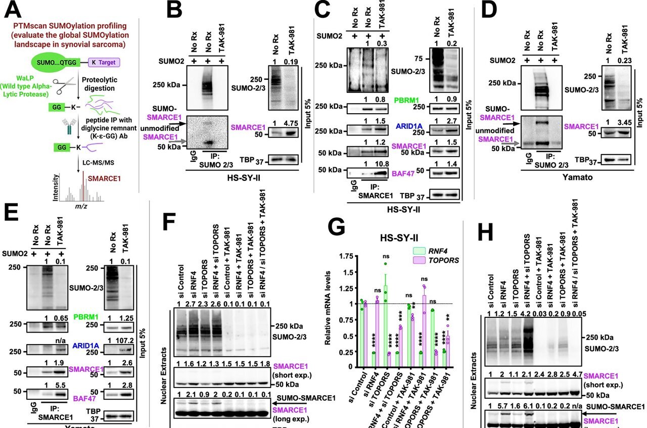 Targeted drug could benefit young patients with invasive sarcoma