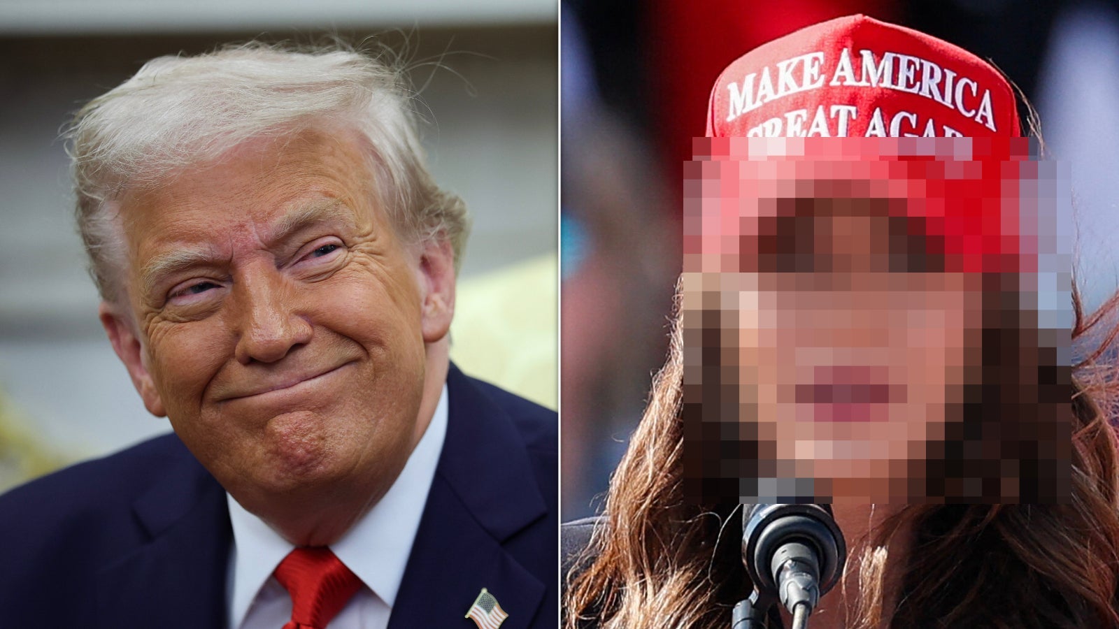 Plastic Surgeons Say They’re Getting Requests For 1 Unsettling Look ...