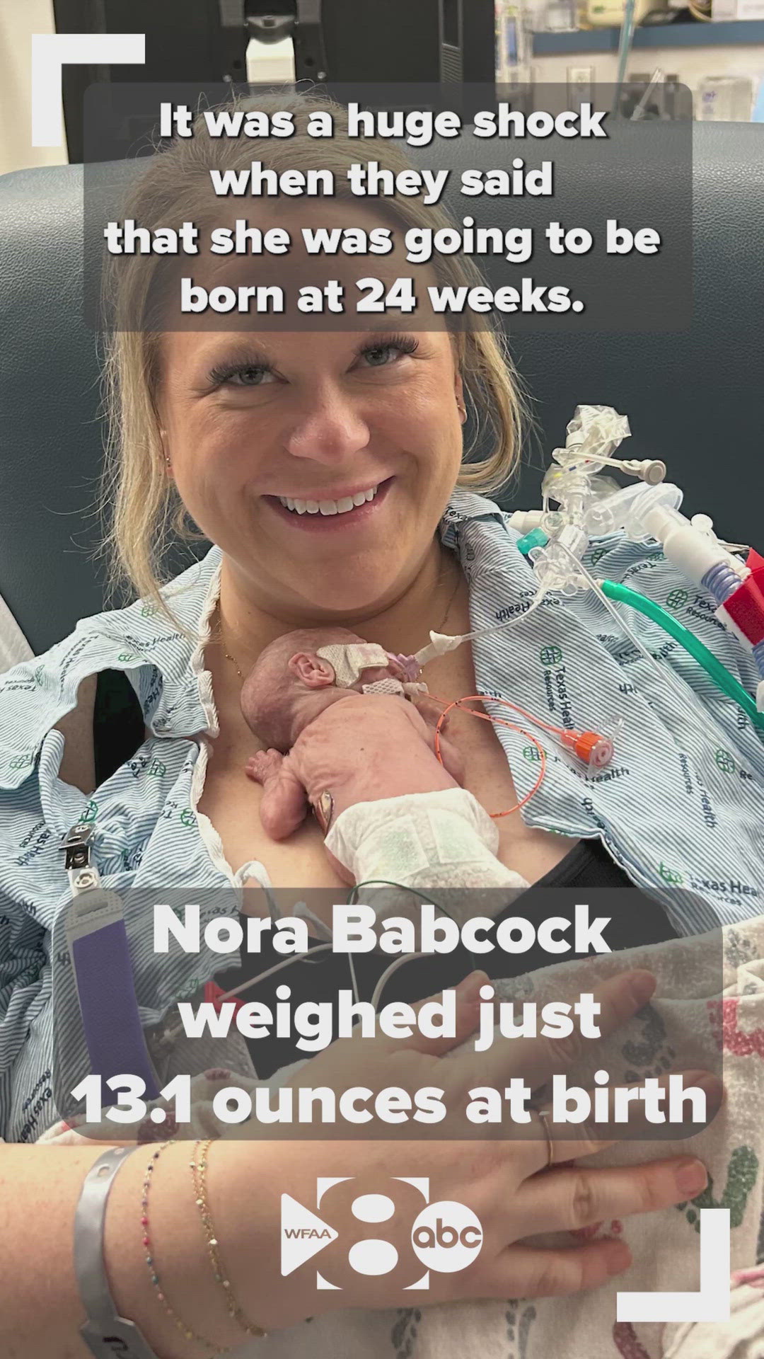 'Micro-preemie' born at less than one pound thrives after state-of-the ...