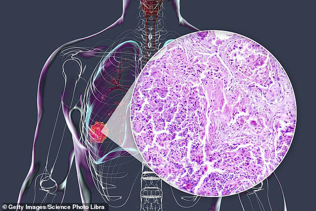 Breakthrough as 40-year-old drug is revamped to destroy cancer cells