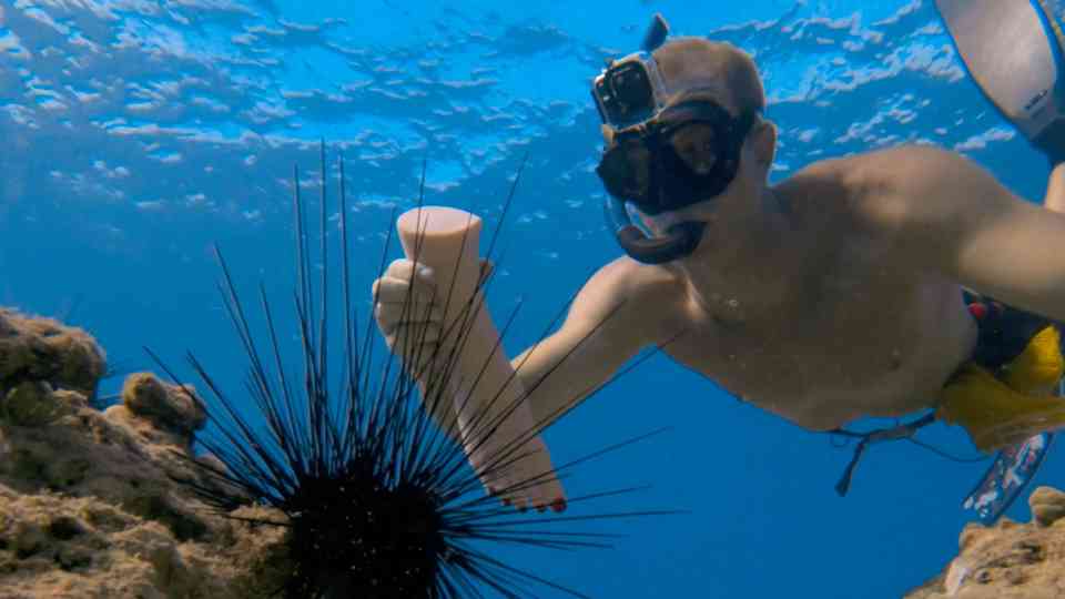 What Happens When You Step on a Sea Urchin? (Fake Foot Demo)