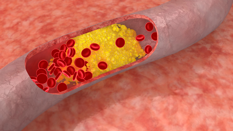 Doctors say this simple drink works wonders for Arteries, and lowers ...