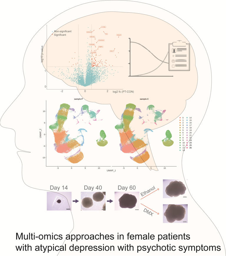 KAIST study links immune system dysregulation to depression symptoms