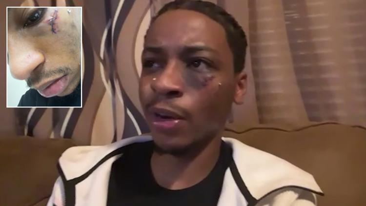'It was traumatizing' | Houston fan's night out ends in ER after glass ...