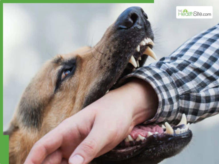 Tamil Nadu Reports 5.25 Lakh Dog Bite Cases, 28 Deaths Due To Rabies In ...
