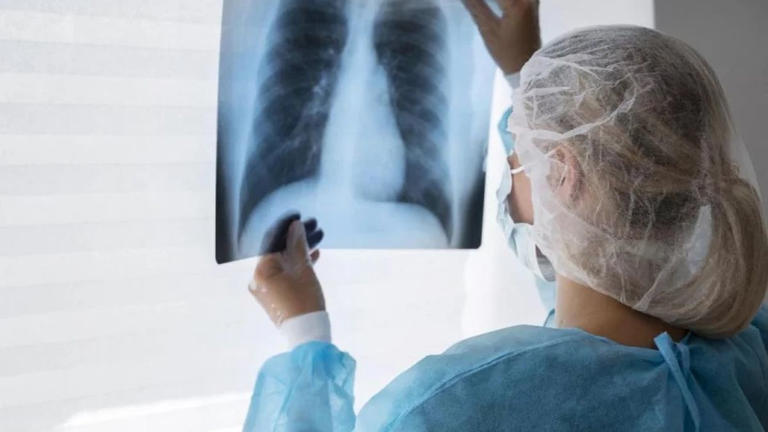 La UBA desarrolla una terapia para acortar el tratamiento contra la ...