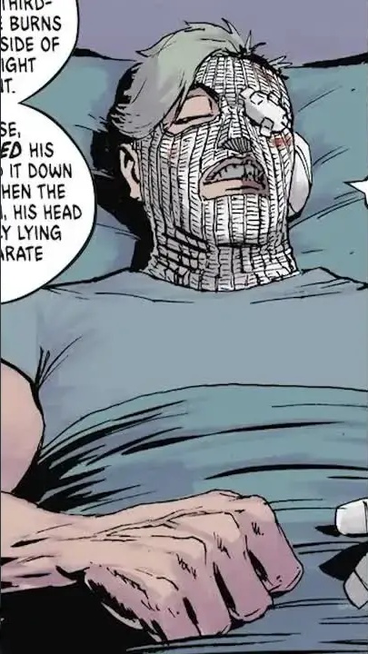 Bane turns absolute Batman’s friend into Two-Face!