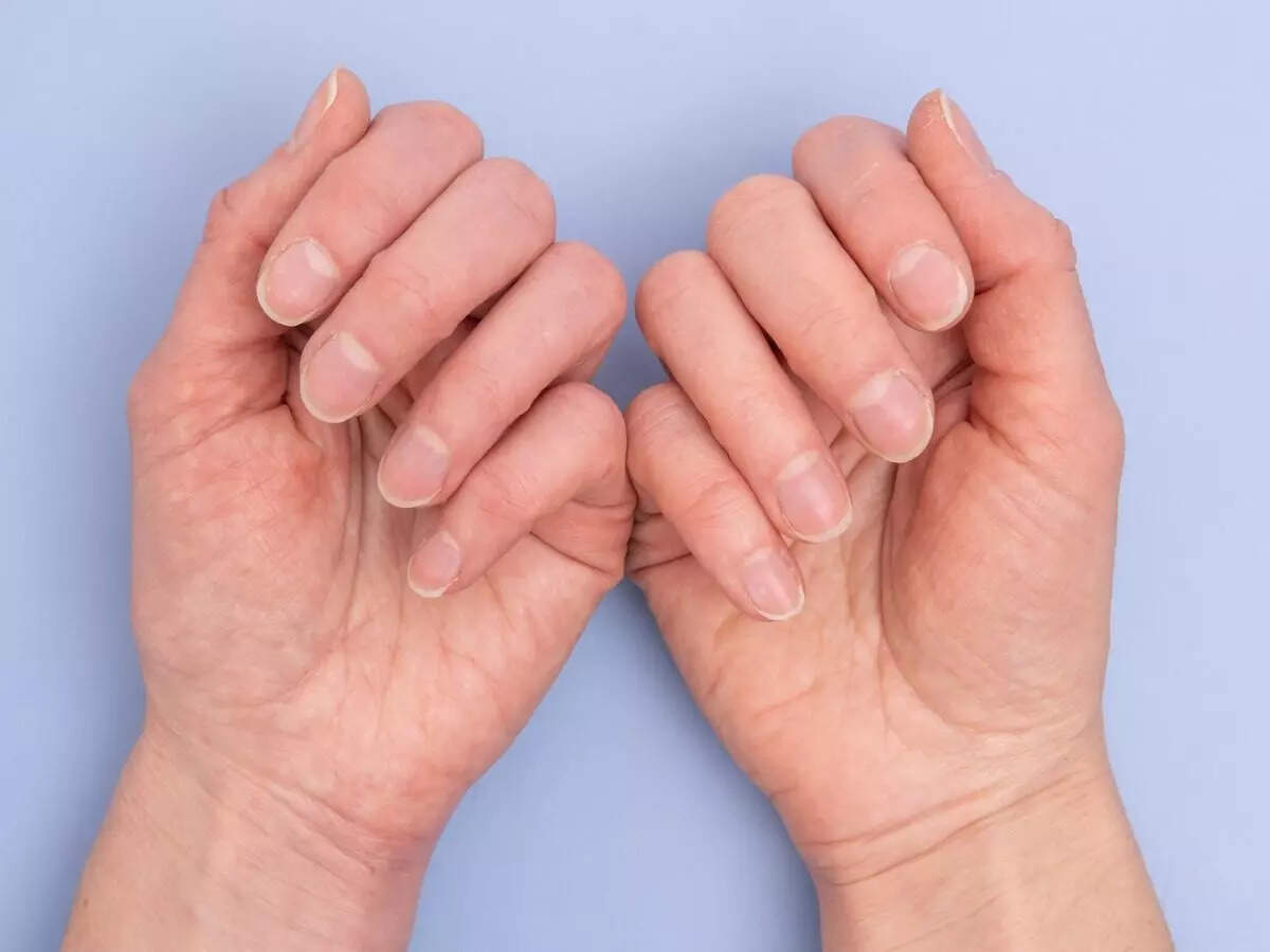 Vital organ malfunction? 5 nail signs that can save your life, just ...
