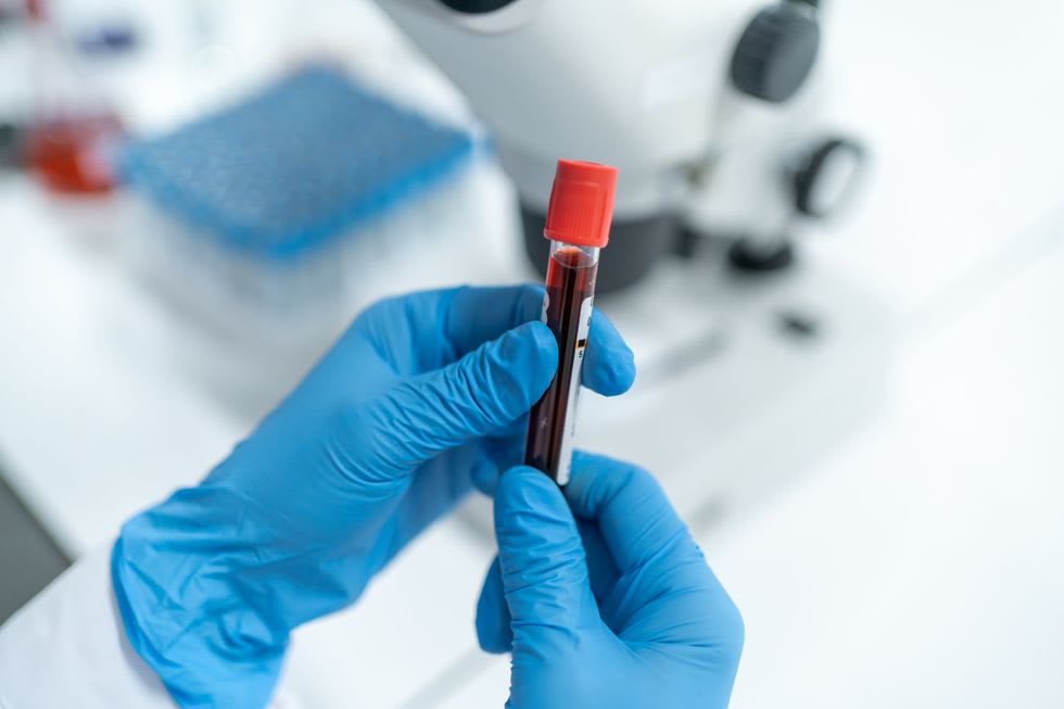Pinprick blood test could spot killer diseases a decade early as ...